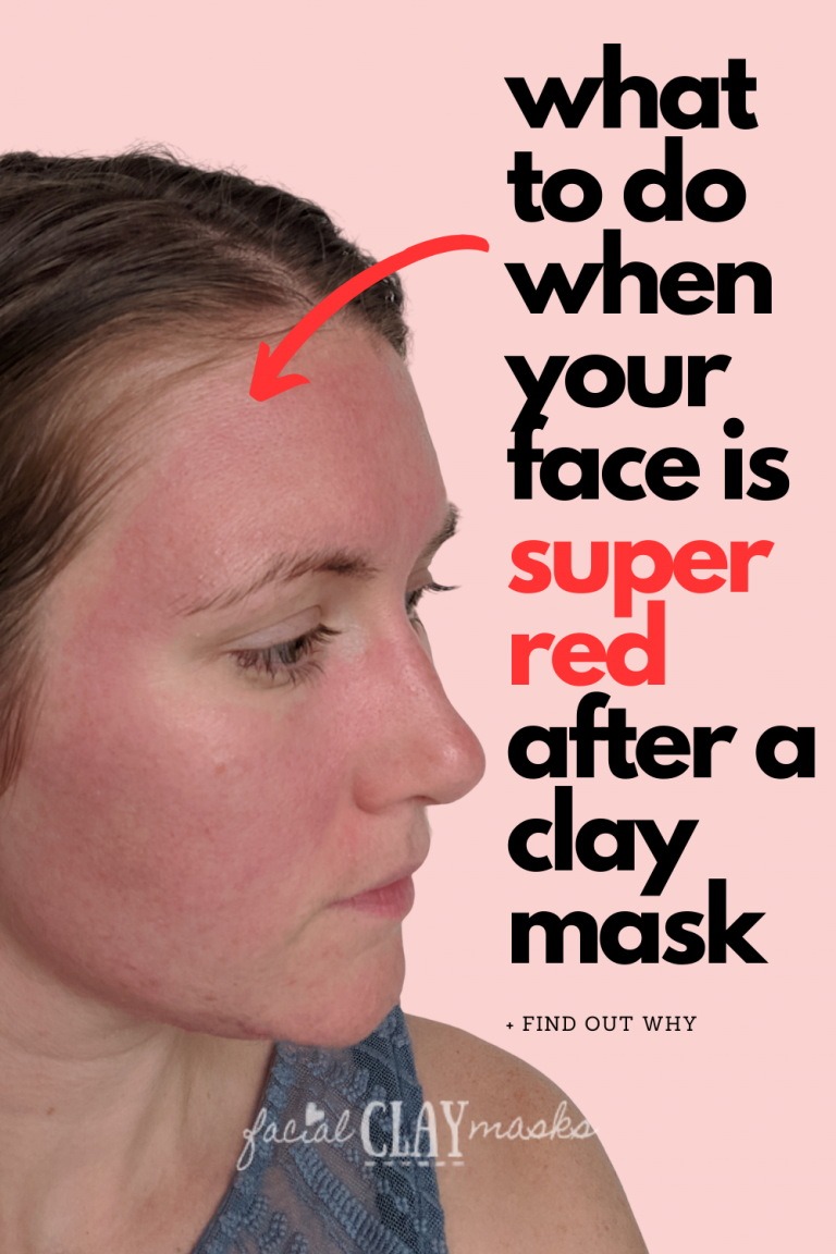 Do you have Redness after a Clay Mask? Here's what to do.
