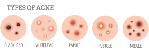 Berry Minty Purifying Strawberry Face Mask